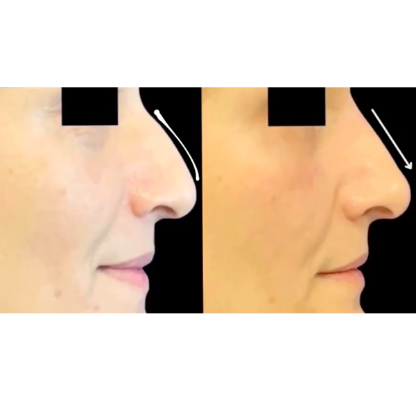 Washington DC Plastic Surgery | Tysons Corner Facelift, Rhinoplasty ...